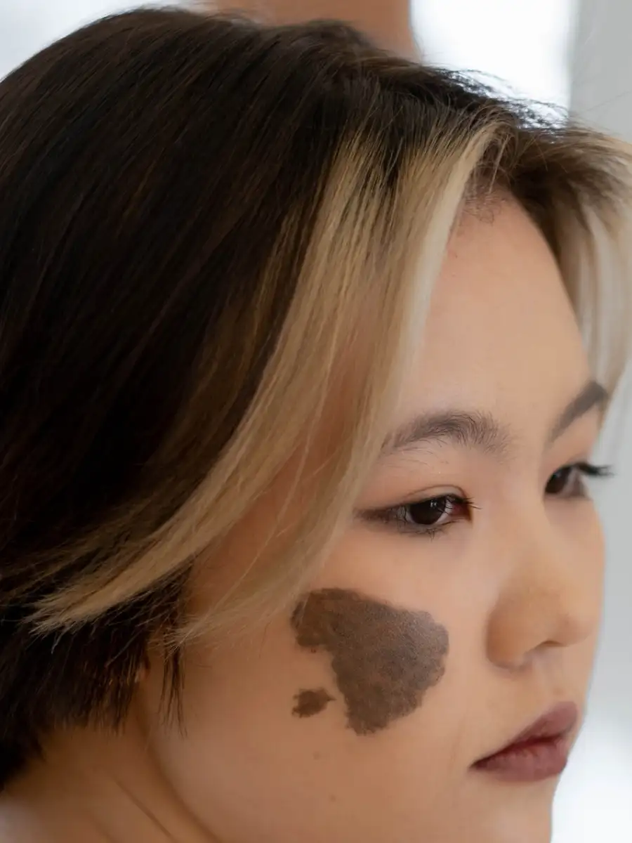 Birthmarks: Here’s how birthmarks tell a lot about your past life ...