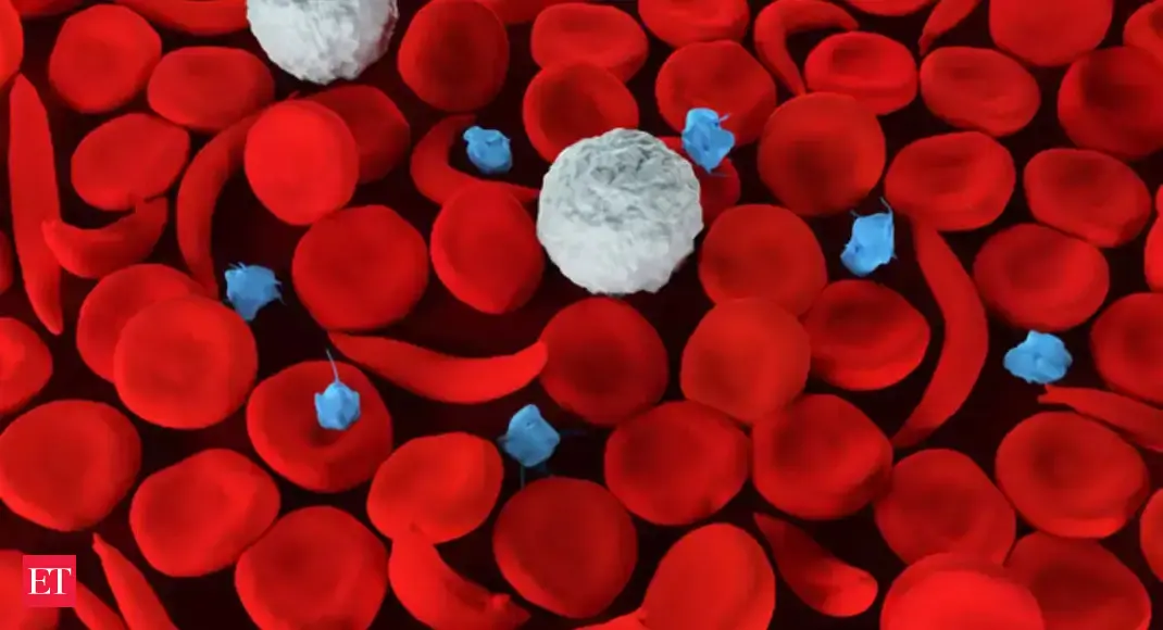 sickle cell anaemia elimination: Mission to eliminate sickle cell ...