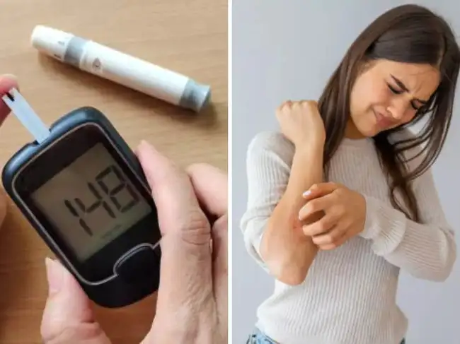 Blood sugar: High blood sugar can be a silent killer, don’t ignore ...