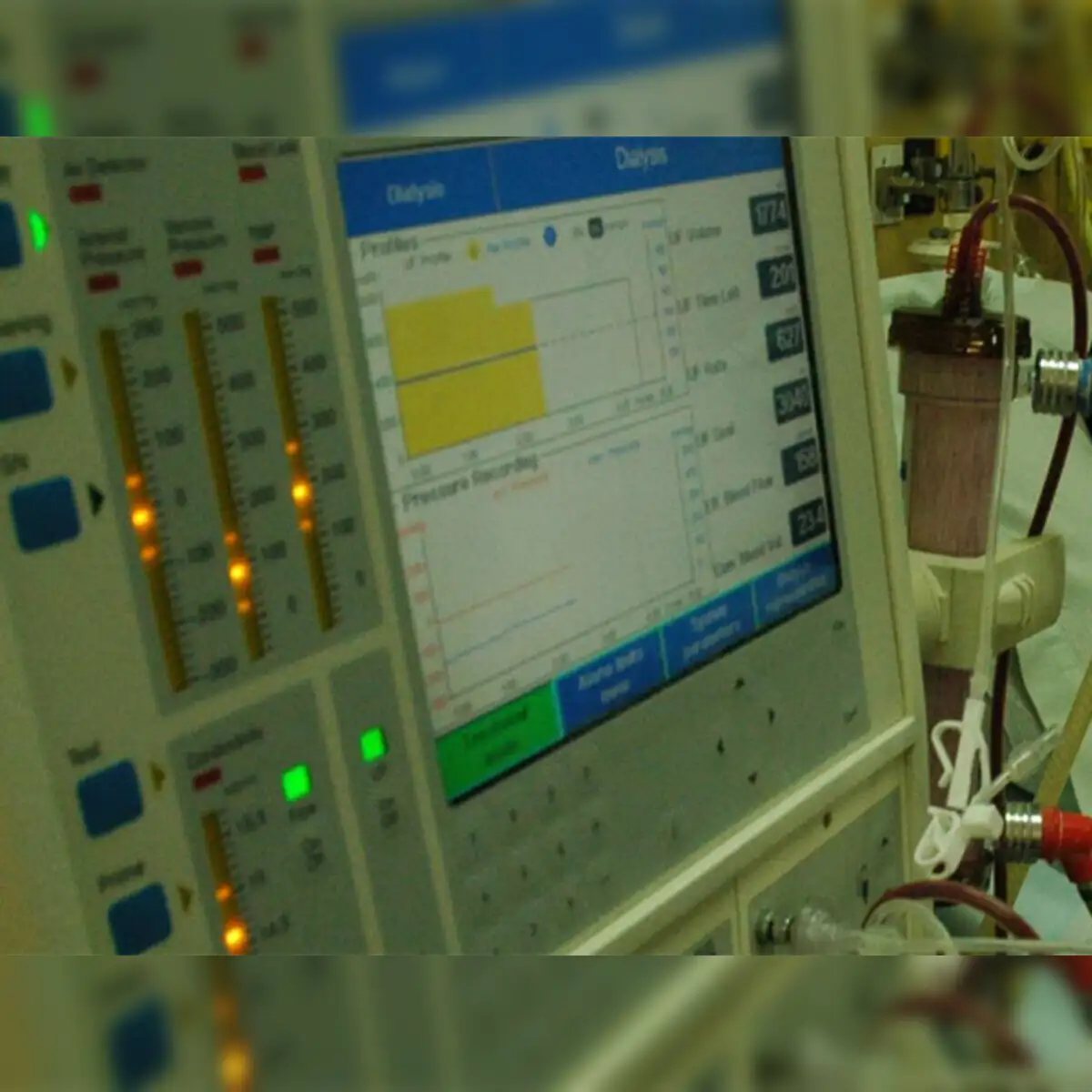 Penlon Logo Anesthesia Vaporizer Sigma Delta (Isoflurane) PENLON