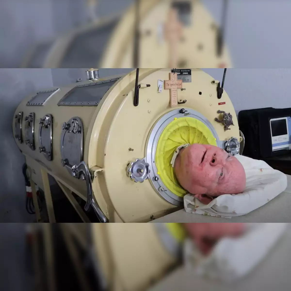 Polio Iron Lung Iron Lung: 1929 Drinker Respirator