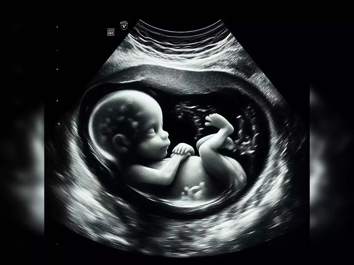 No female foeticide, knowing sex or not - The Economic Times