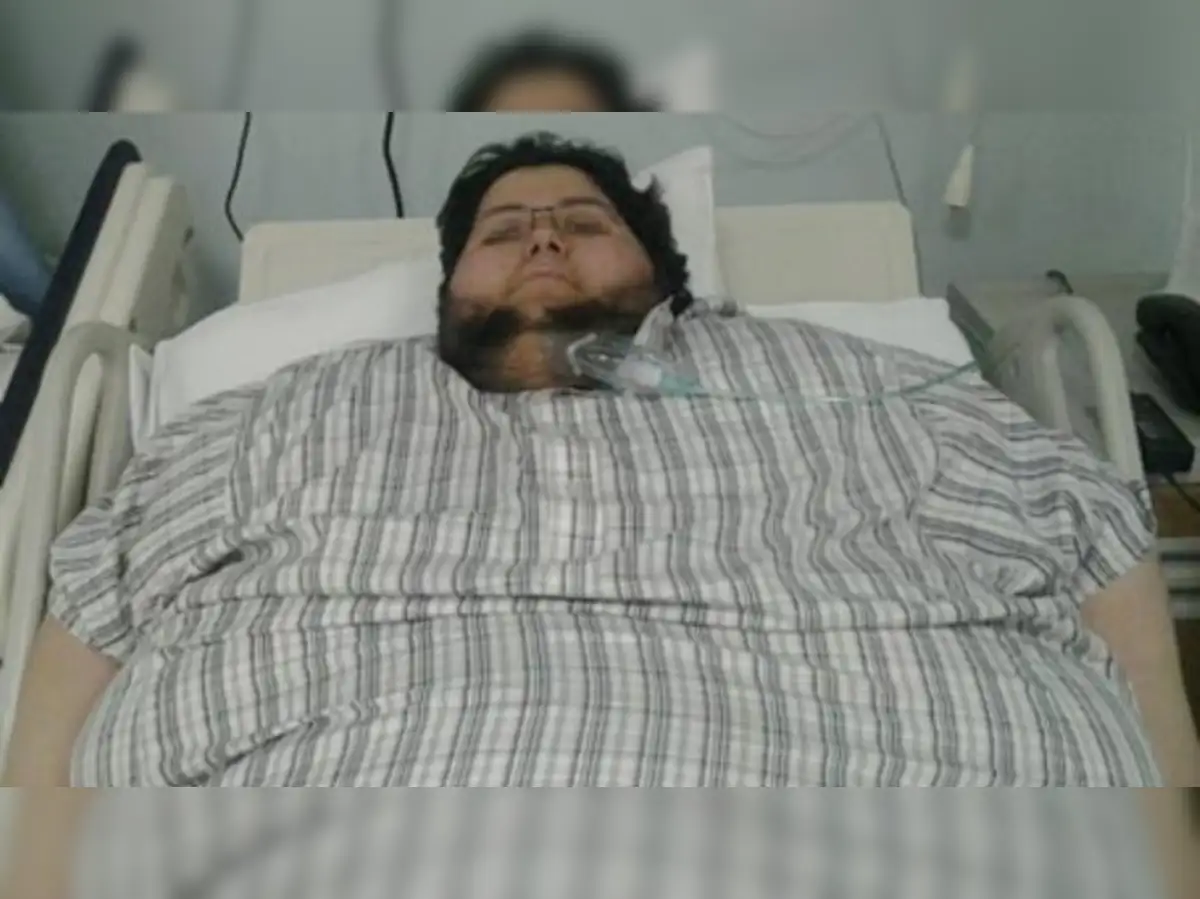 Worlds Fattest Man 2024