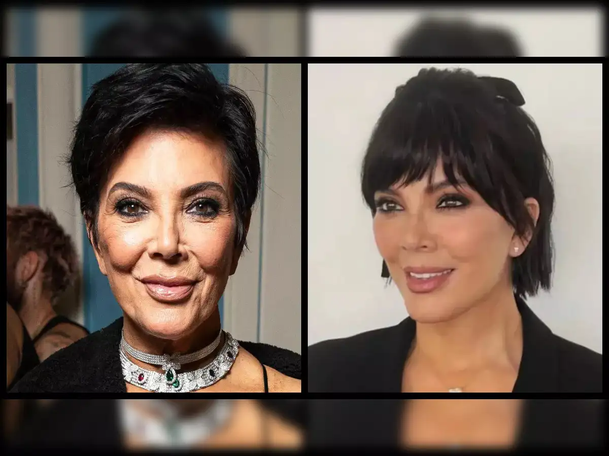 Images Kris Kris Jenner's Plastic Surgeon Goes Viral After Her New