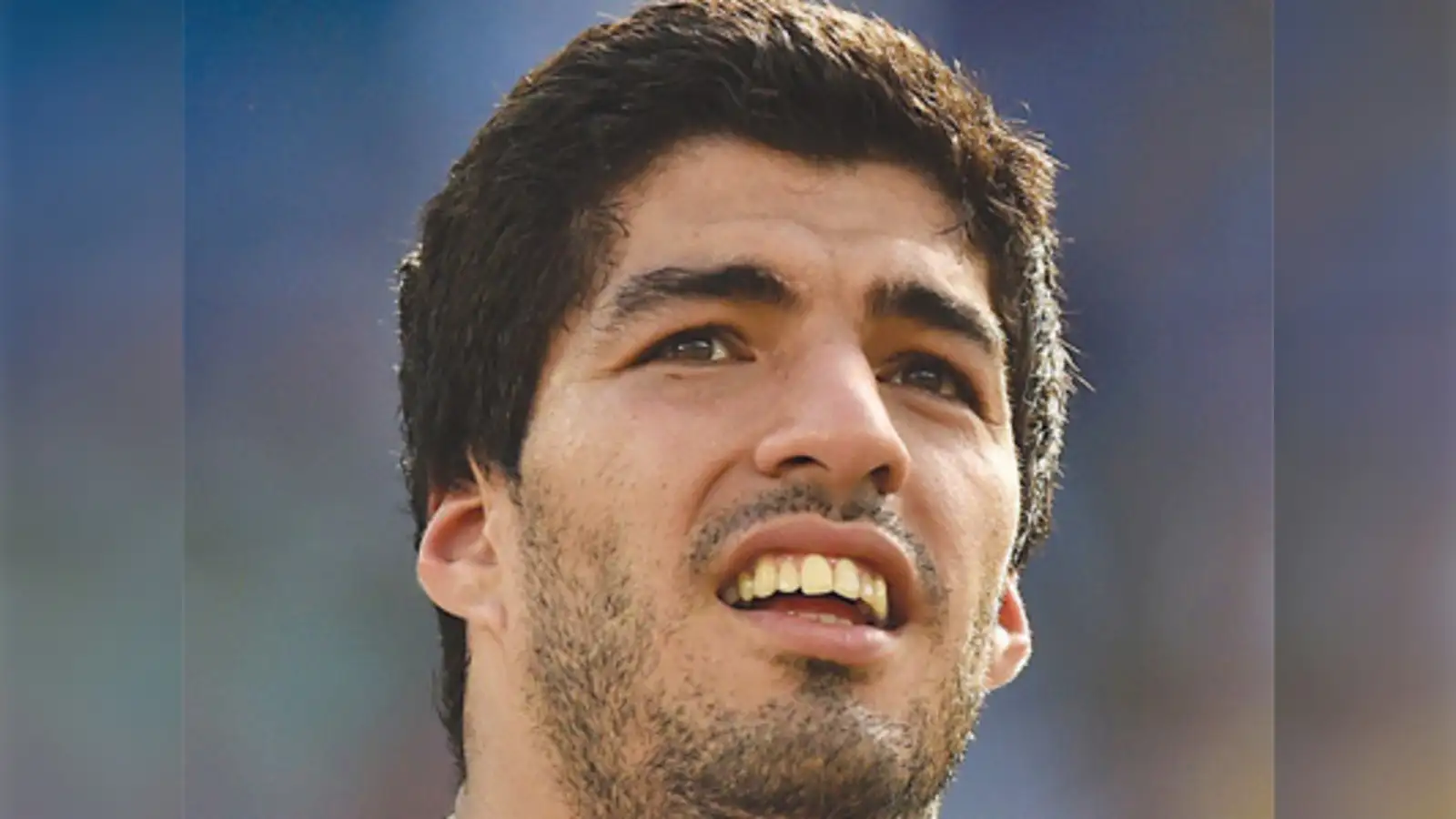 luis suarez teeth fixed