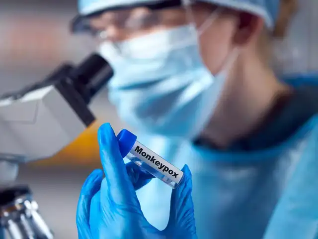 Monkeypox India: Do's, don'ts and types. Read details here