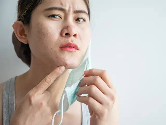 skin cancer: New bandage made with magnetic nano-fibres can kill skin ...